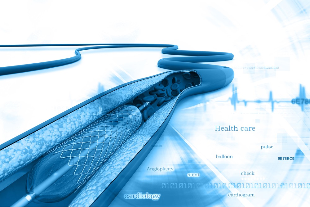 Aortyx | Invermercado